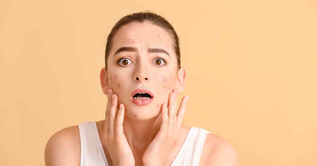 【4MSKとは？】シミやくすみのない透明素肌に導くうれしい効果やおすすめの4MSK配合化粧品を発表 | ONEcosme