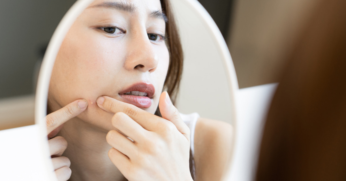 40代にできる口の周りの吹き出物の原因と治し方は？年齢に合ったケアと美肌習慣で肌トラブルを卒業 | ONEcosme